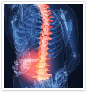 Paralysis, Spinal Cord or Spinal Injury – Attorney Injury Lawyers Of ...